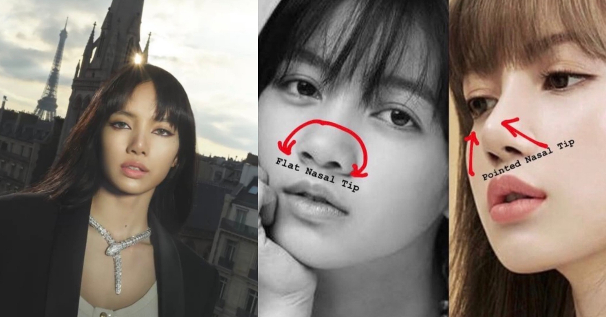 Netizen tranh cãi: Lisa Blackpink có sửa mũi hay không?