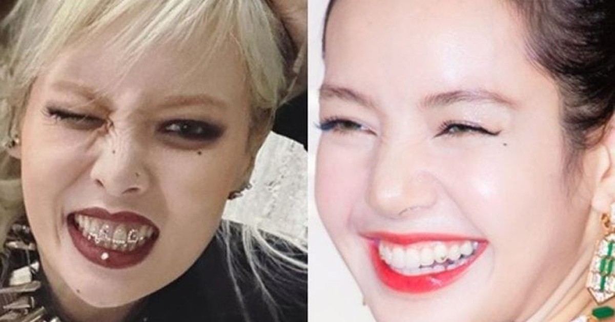 'Tooth gem' đang trở thành trend trong K-biz